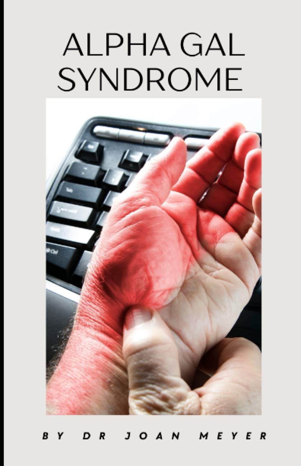 Buy ALPHA GAL SYNDROME: Everything you need to know about alcoholism ...