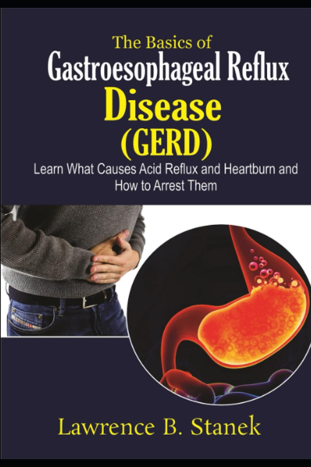 The Basics of Gastroesophageal Reflux Disease (GERD): Learn What Causes ...