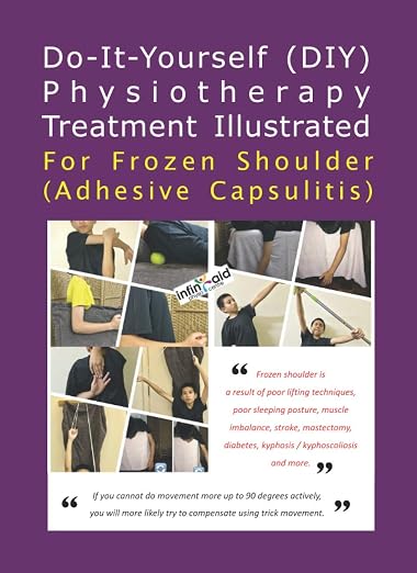 Physiotherapy Treatment Illustrated For Frozen Shoulder (Adhesive ...