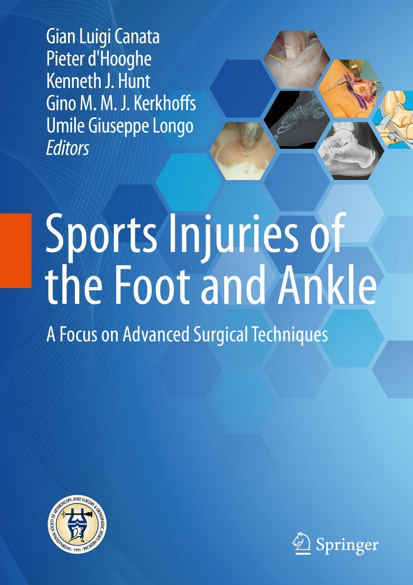 Buy Sports Injuries of the Foot and Ankle: A Focus on Advanced Surgical ...