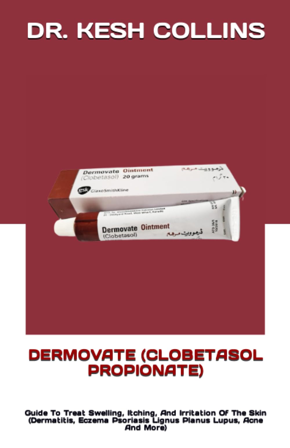 Buy DERMOVATE (CLOBETASOL PROPIONATE): Guide To Treat Swelling, , And ...