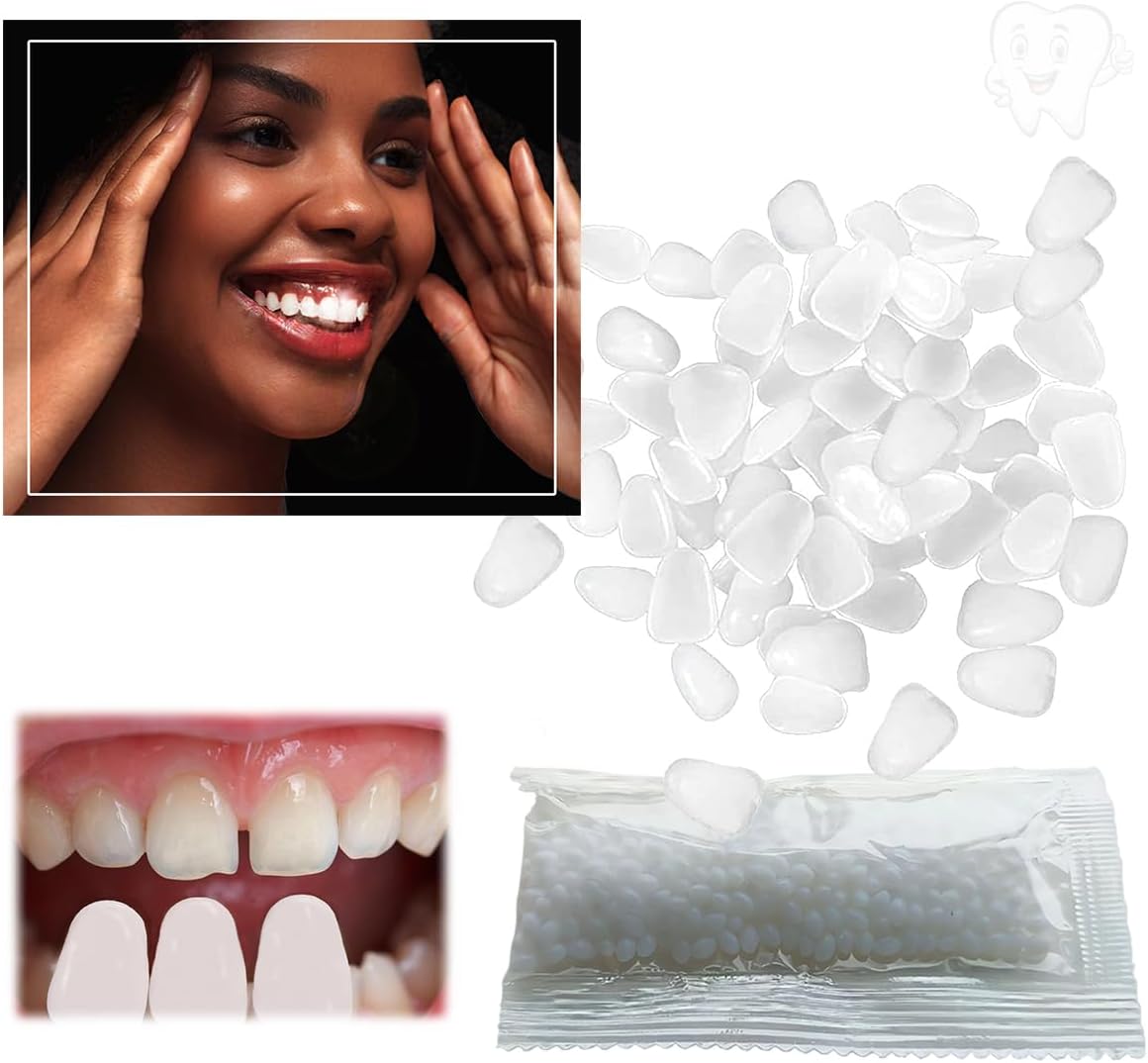 Amazon.com: Tooth Repair Kit-Thermal Fitting Beads Granules and Fake ...