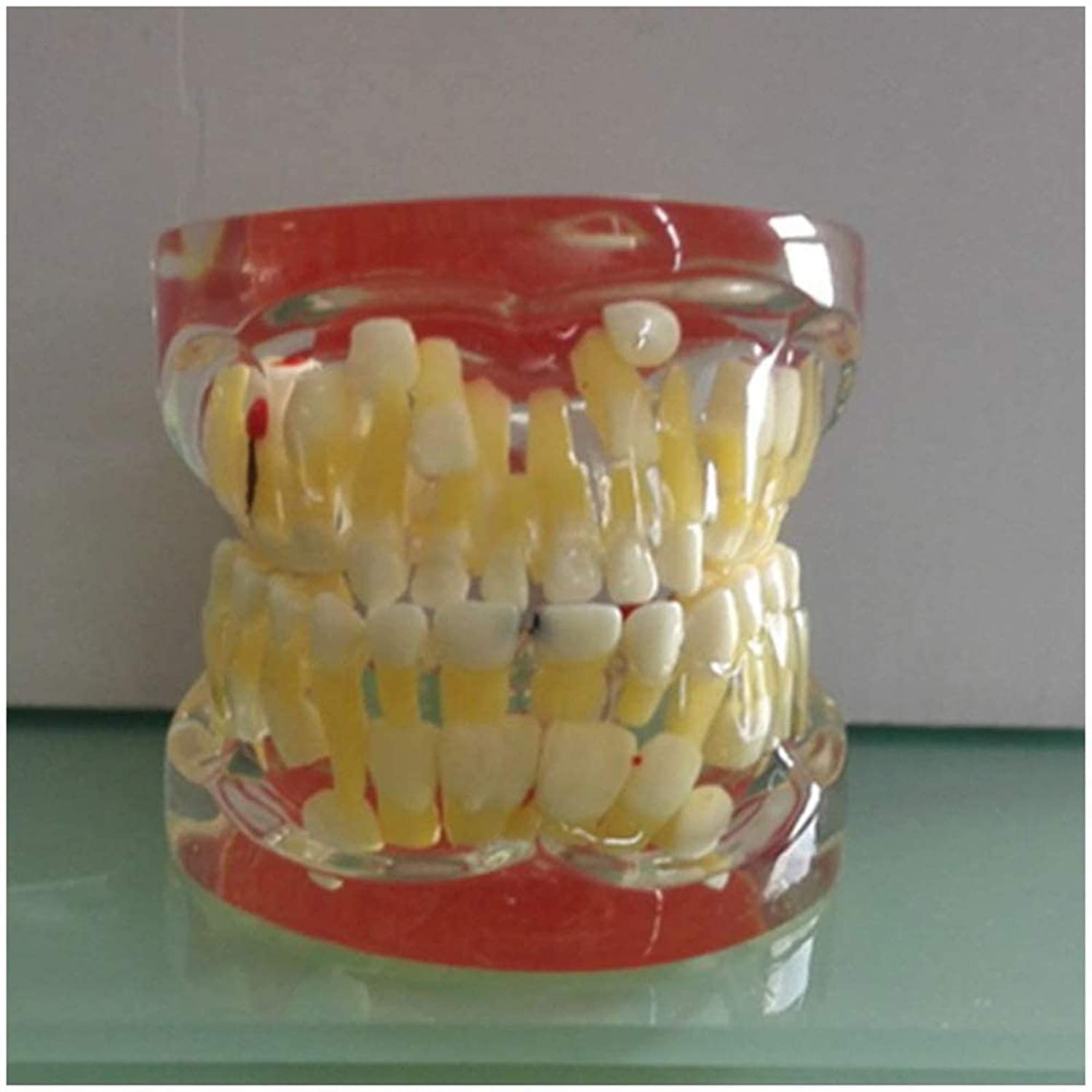 Buy QHYXT Pathologic Deciduous Teeth Model - Transparent Dental Teeth ...