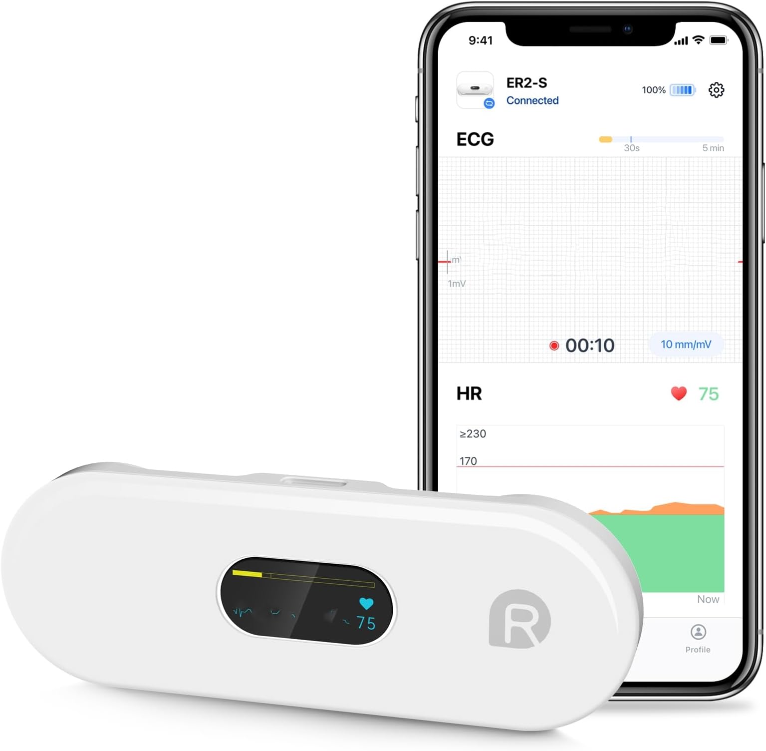 Wellue DUOEK-S Portable ECG Monitor, ECG Machine for Home with ...