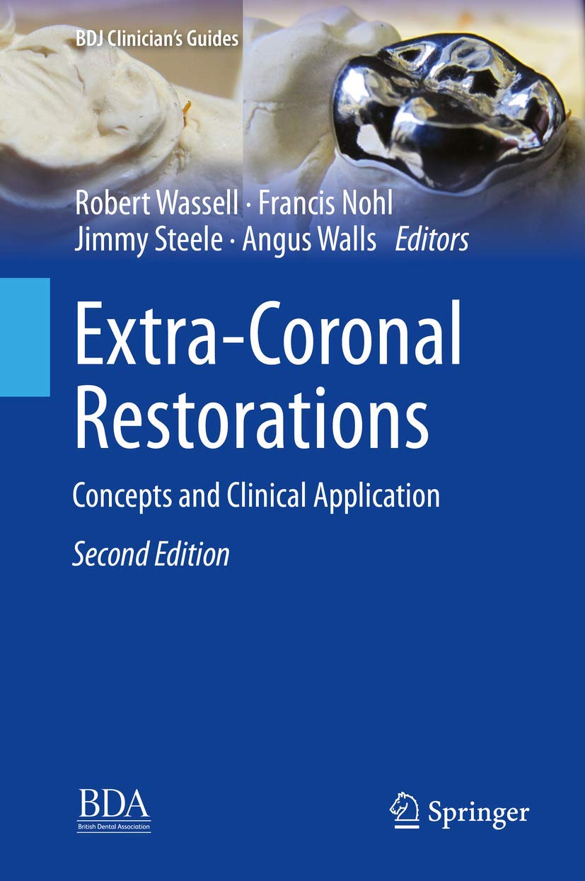 Extra-Coronal Restorations: Concepts and Clinical Application (BDJ ...