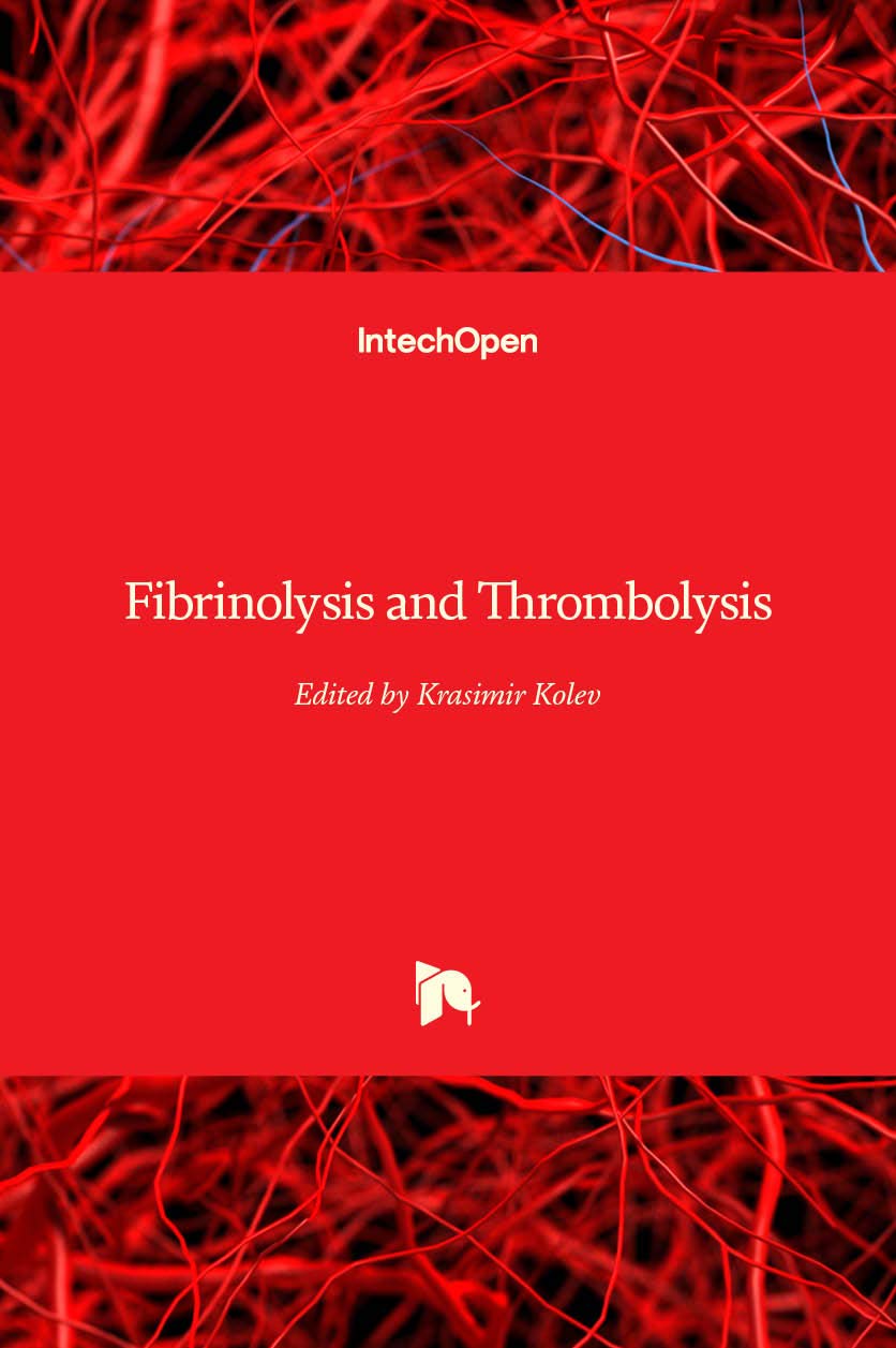 Fibrinolysis and Thrombolysis: Buy Online at Best Price in Egypt - Souq ...