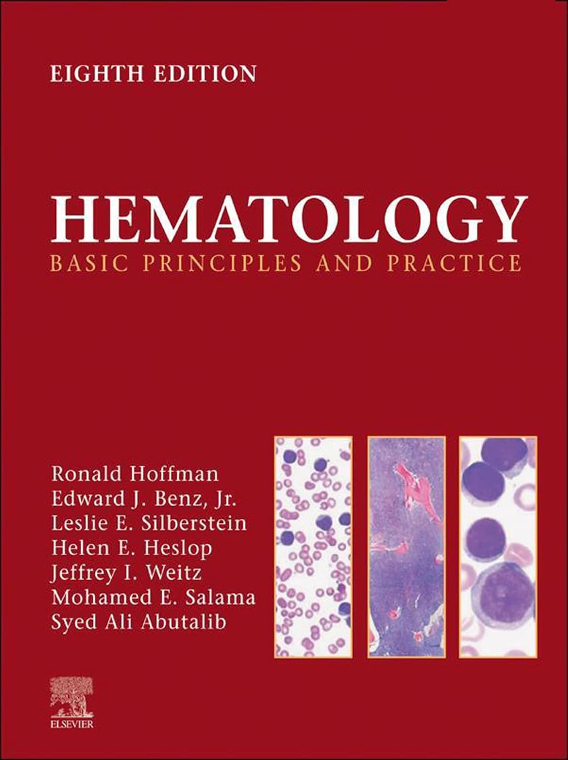 Amazon.com: Hematology E-Book: Basic Principles and Practice eBook ...