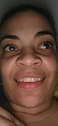 CREADENT Kit for Replacing a Missing Tooth with a Temporary Cosmetic ...