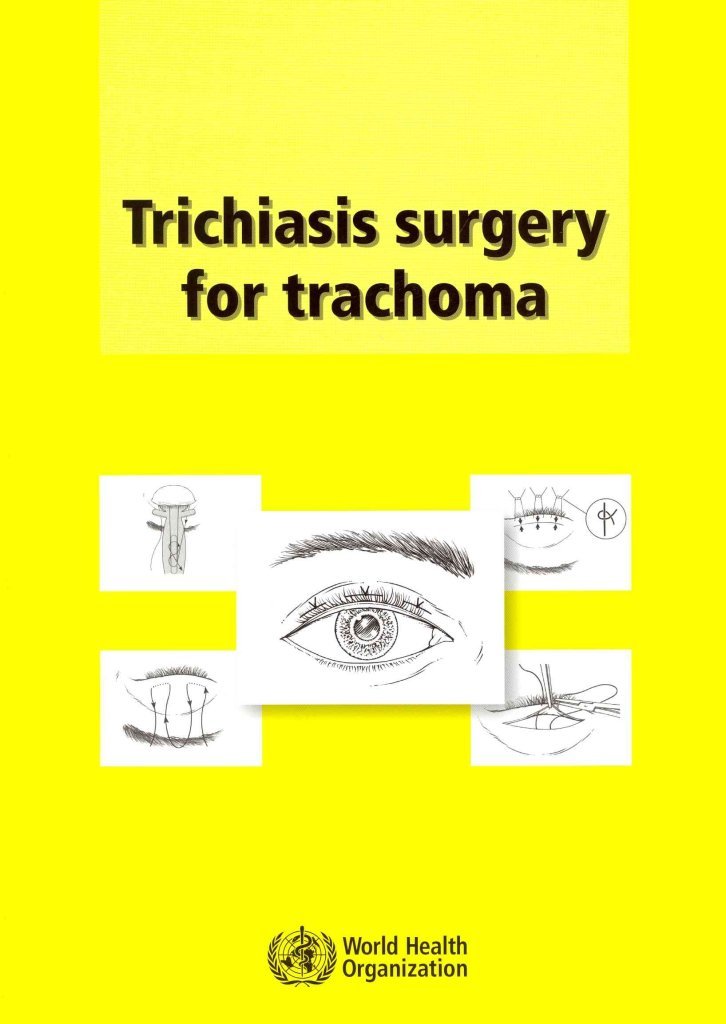 Trichiasis Surgery for Trachoma: 9789241548670: Medicine & Health ...