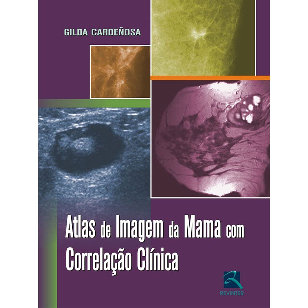 Atlas De Imagem Da Mama Com Correlação Clinica : Amazon.de: Bücher