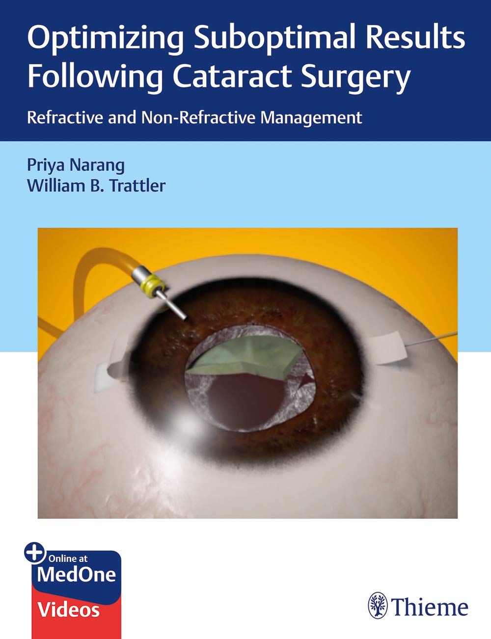 Buy OPTIMIZING SUBOPTIMAL RESULTS FOLLOWING CATARACT SURGERY REFRACTIVE ...