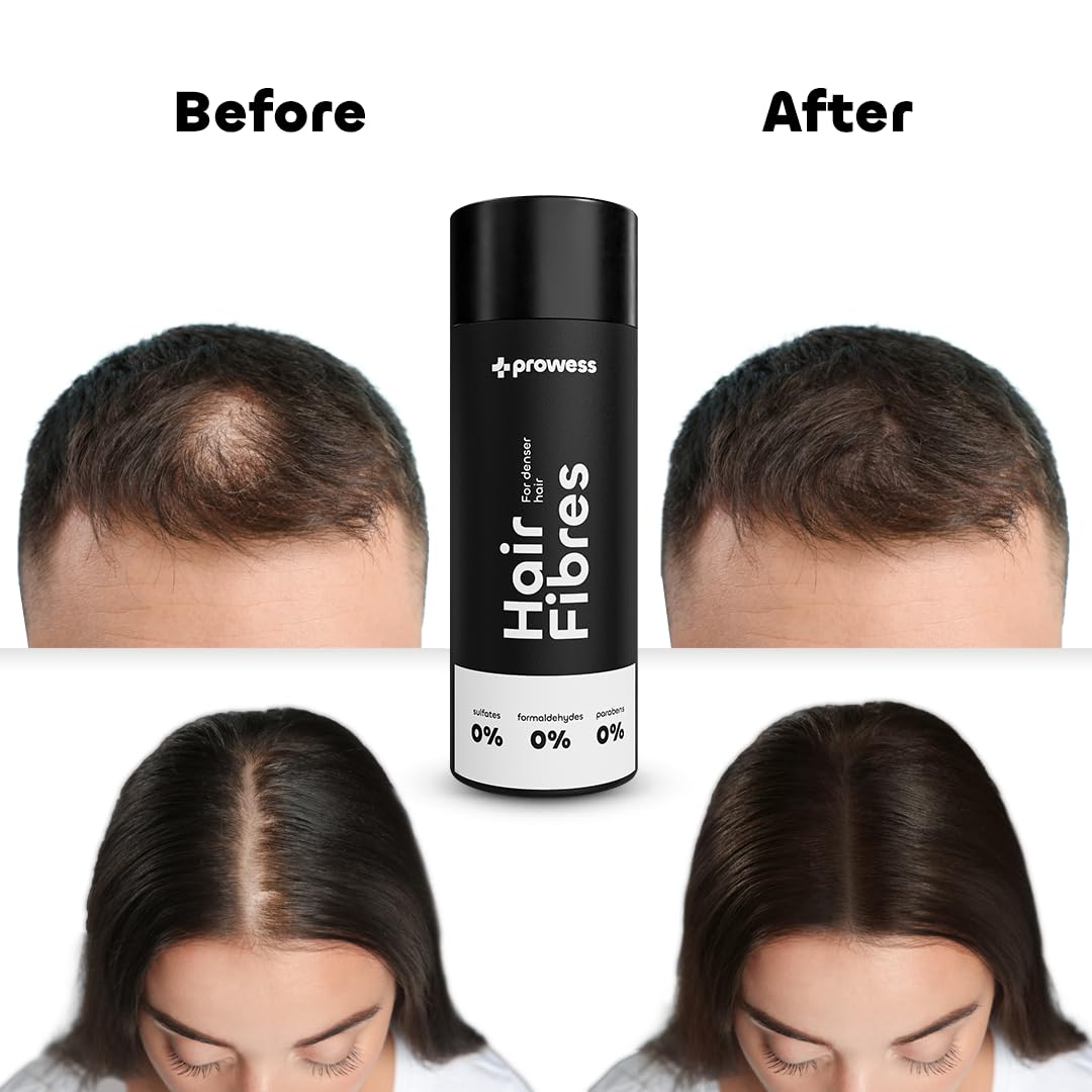 Prowess Dark Brown Hair Building Fibres for Thinning, 50g – Naturally ...