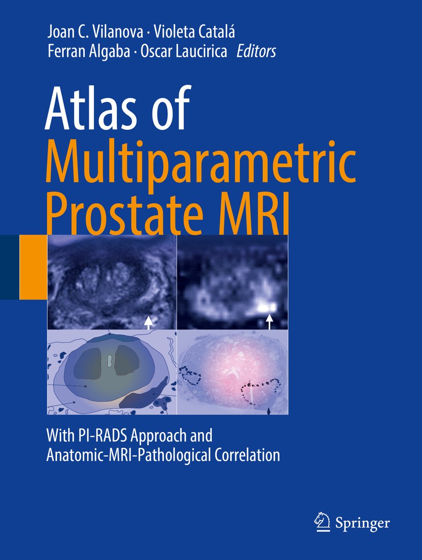 Buy Atlas of Multiparametric Prostate MRI: With PI-RADS Approach and ...