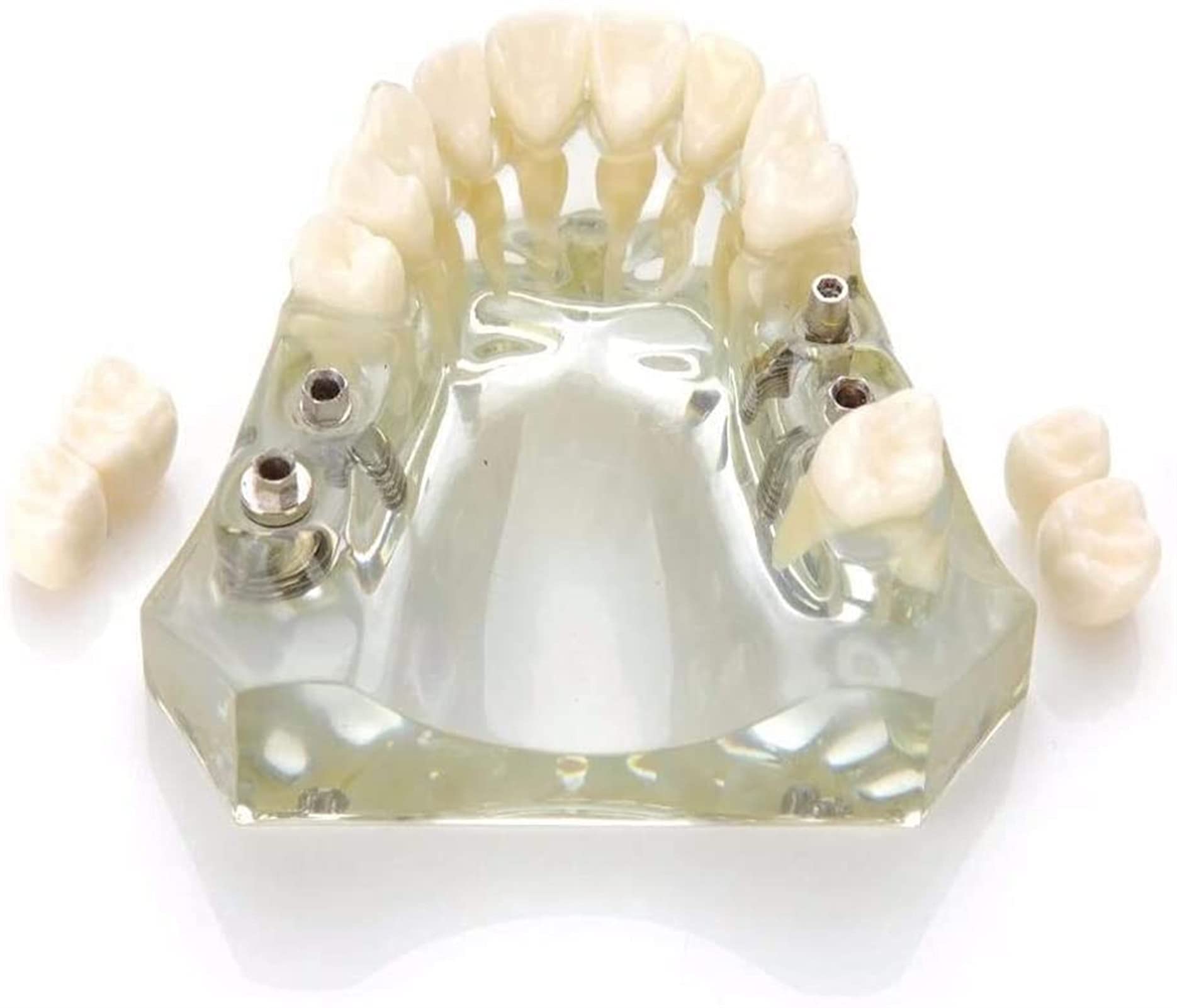 Buy FGVBC Teeth Model Maxillary Im Model - ior Dental Im Restoration ...