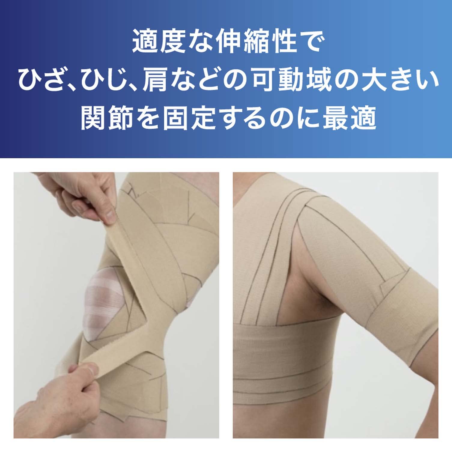 Amazon | ニトムズ ニトリート EBテープ バリューパック スポーツ