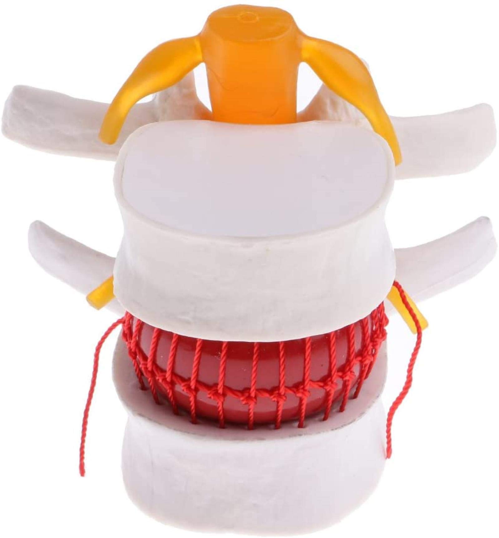 Buy Magnification 2x Human Lumbar Intervertebral Disc Protrusion Model ...