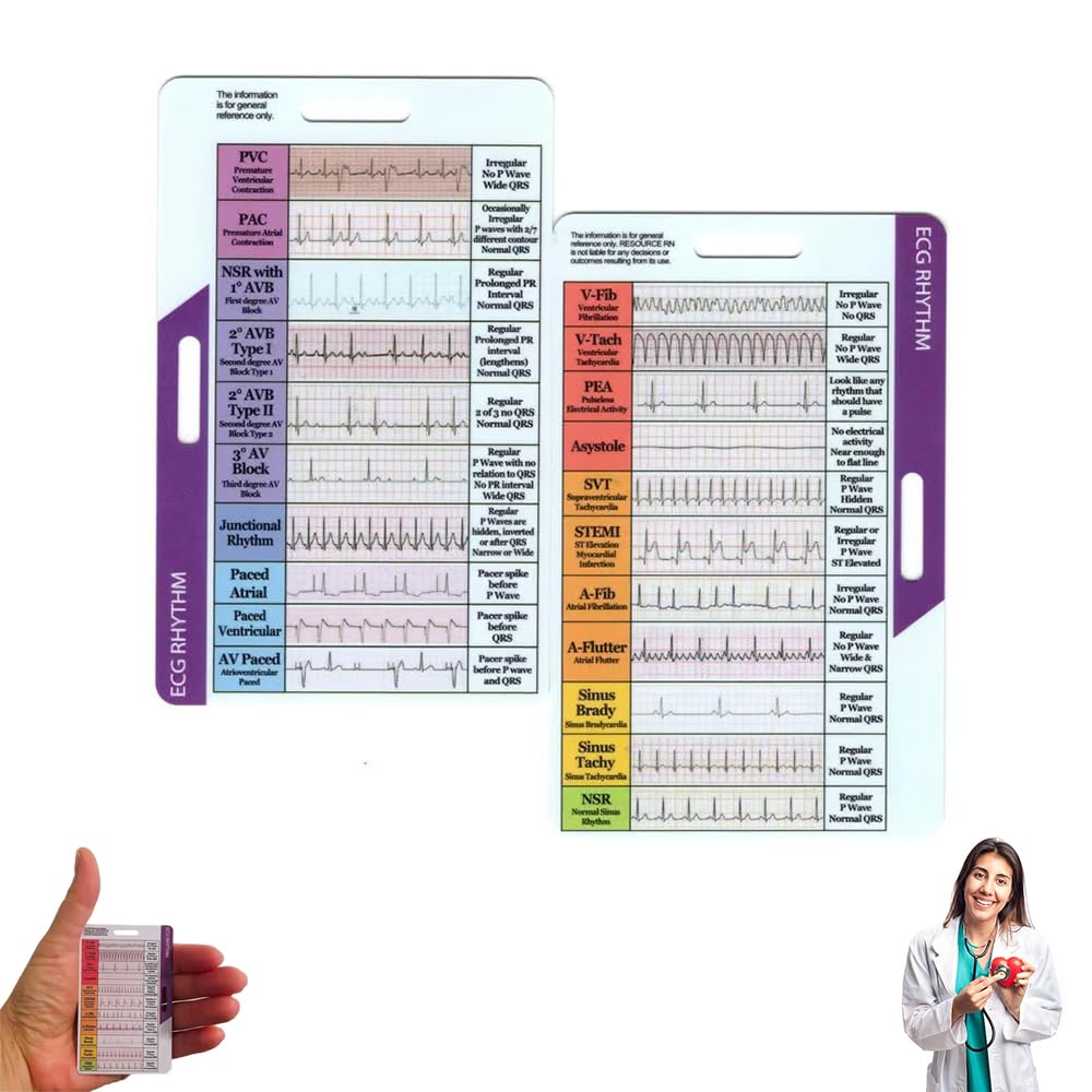 Amazon.com : ECG/EKG Rhythm Pocket Card, 12-Lead STEMI Reference Tool ...