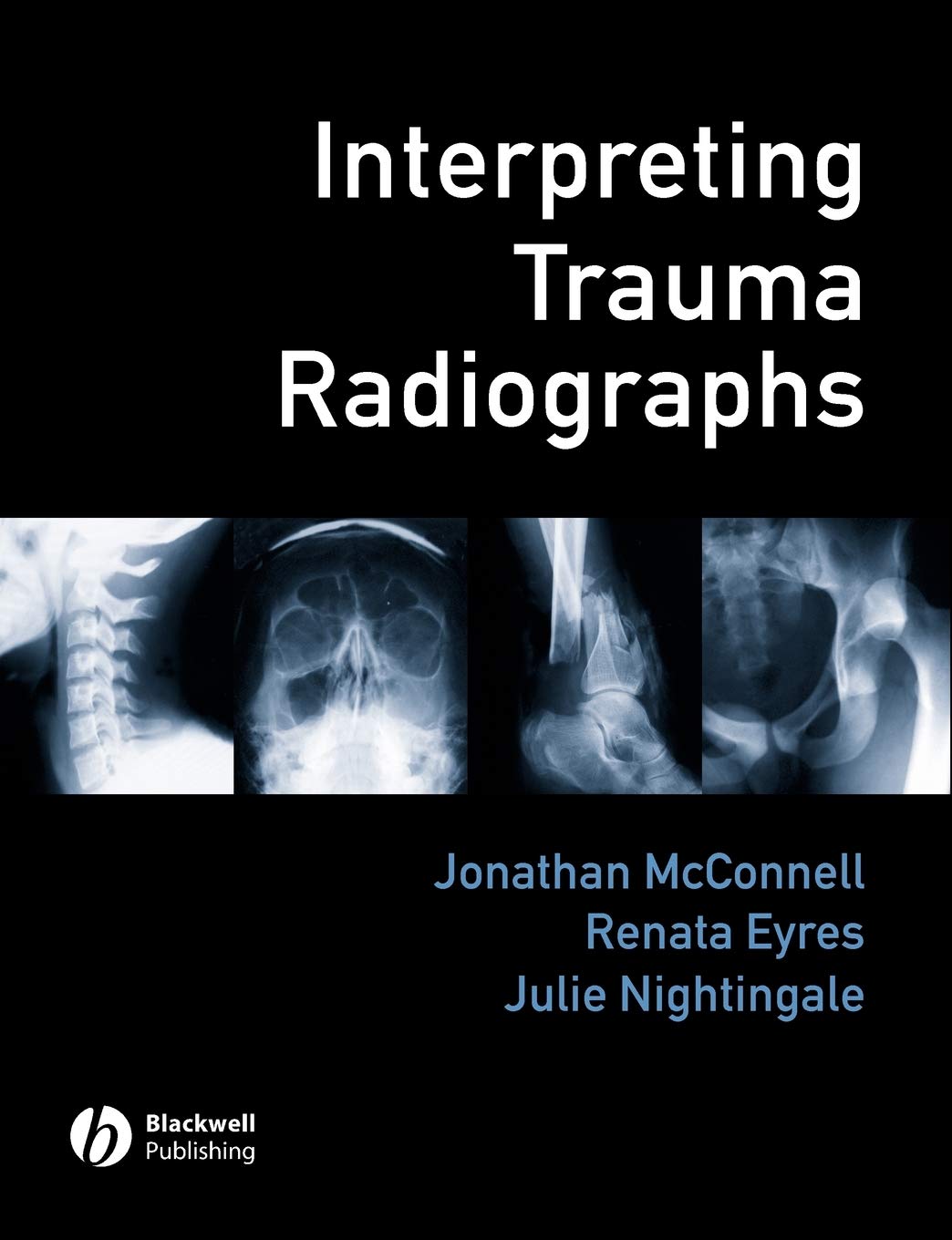Interpreting Trauma Radiographs: 9781405115346: Medicine & Health ...