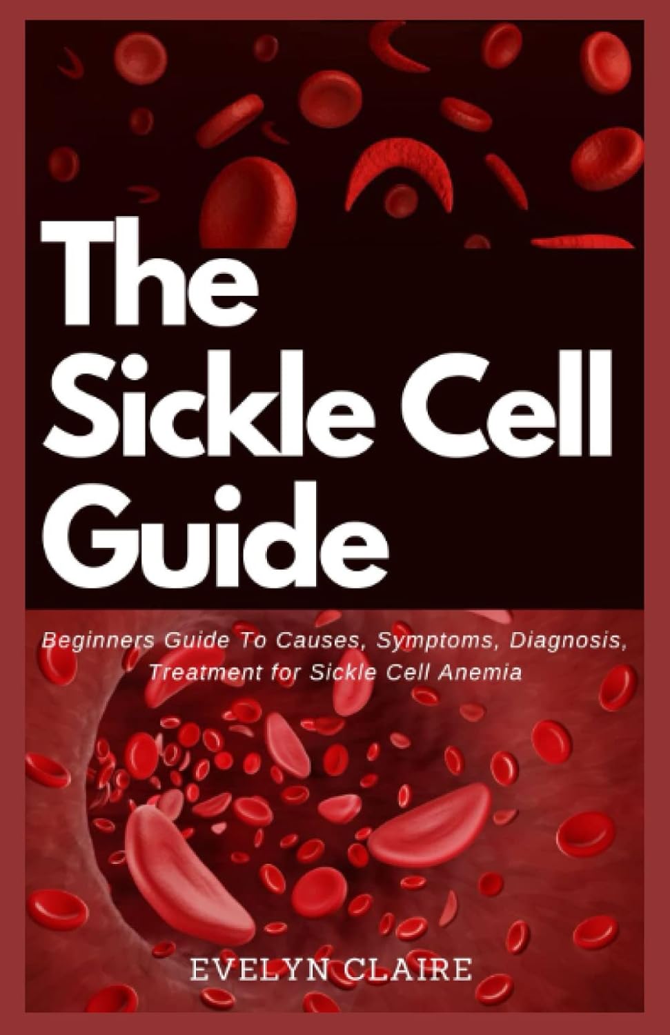 THE SICKLE CELL GUIDE: Beginners Guide To Causes, Symptoms, Diagnosis ...