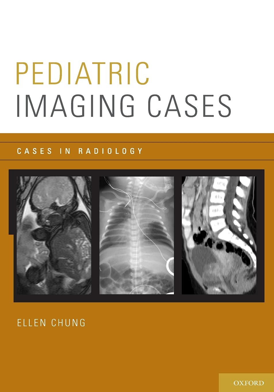 Pediatric Imaging Cases (Cases in Radiology): 9780199758968: Medicine ...