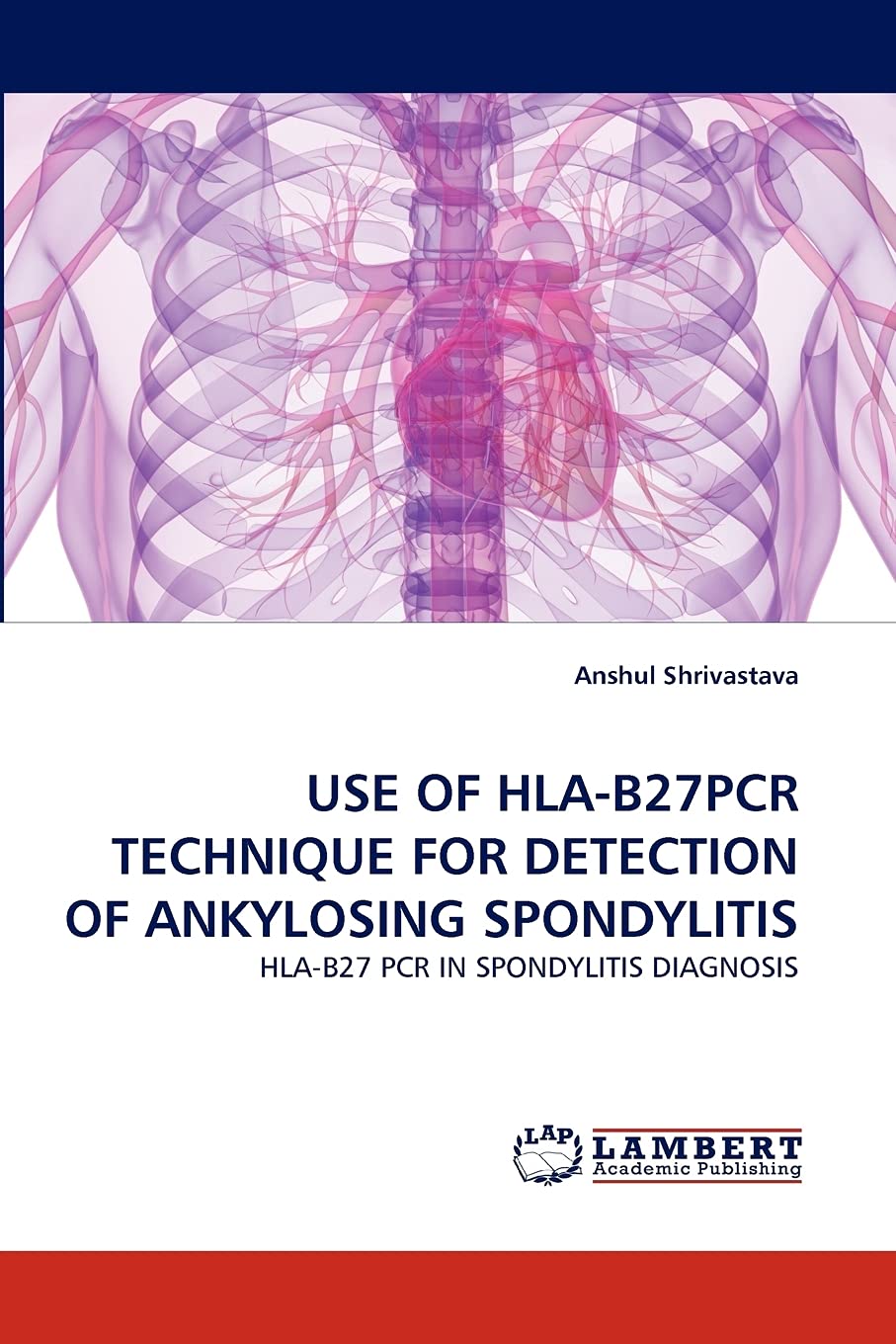 USE OF HLA-B27PCR TECHNIQUE FOR DETECTION OF ANKYLOSING SPONDYLITIS ...