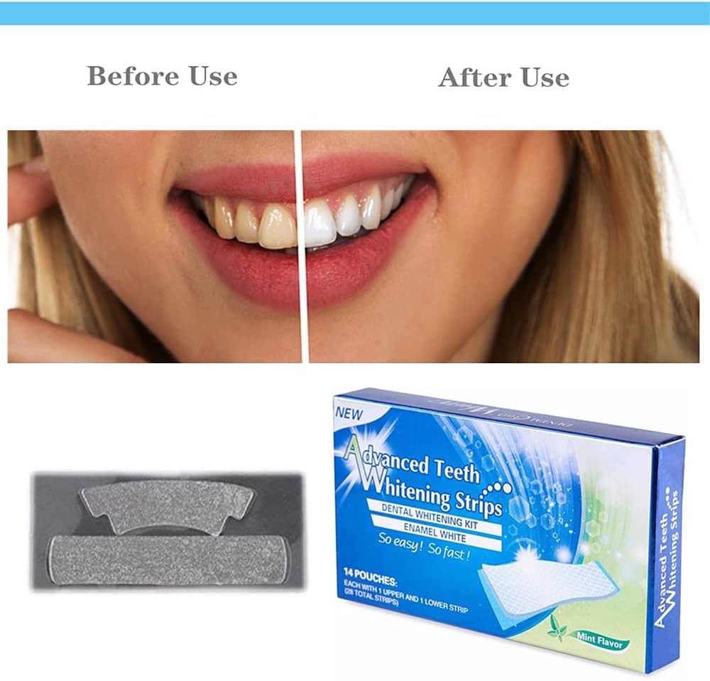 28Pcs Teeth Whitening Strips Advanced Teeth Whitening Strips Teeth ...