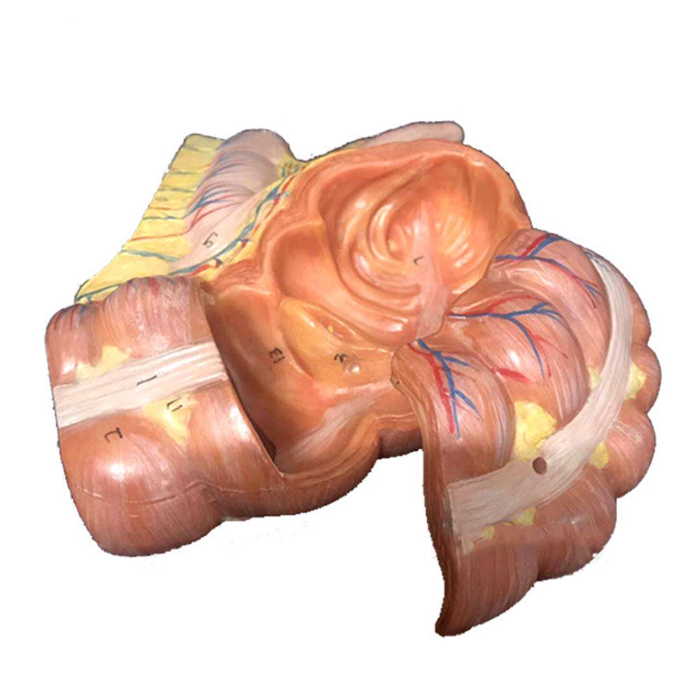 Buy FMOGE Cecum Model - Human Organ Anatomy Model Digestive System ...