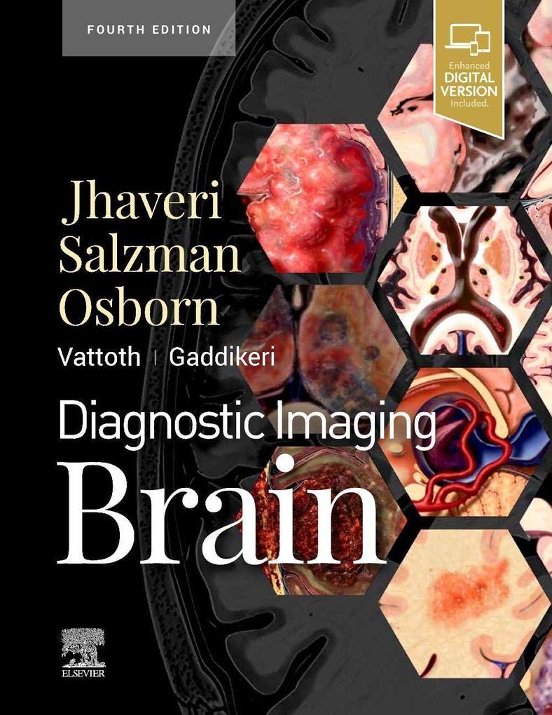 Diagnostic Imaging: Brain: 9780323756204: Medicine & Health Science ...