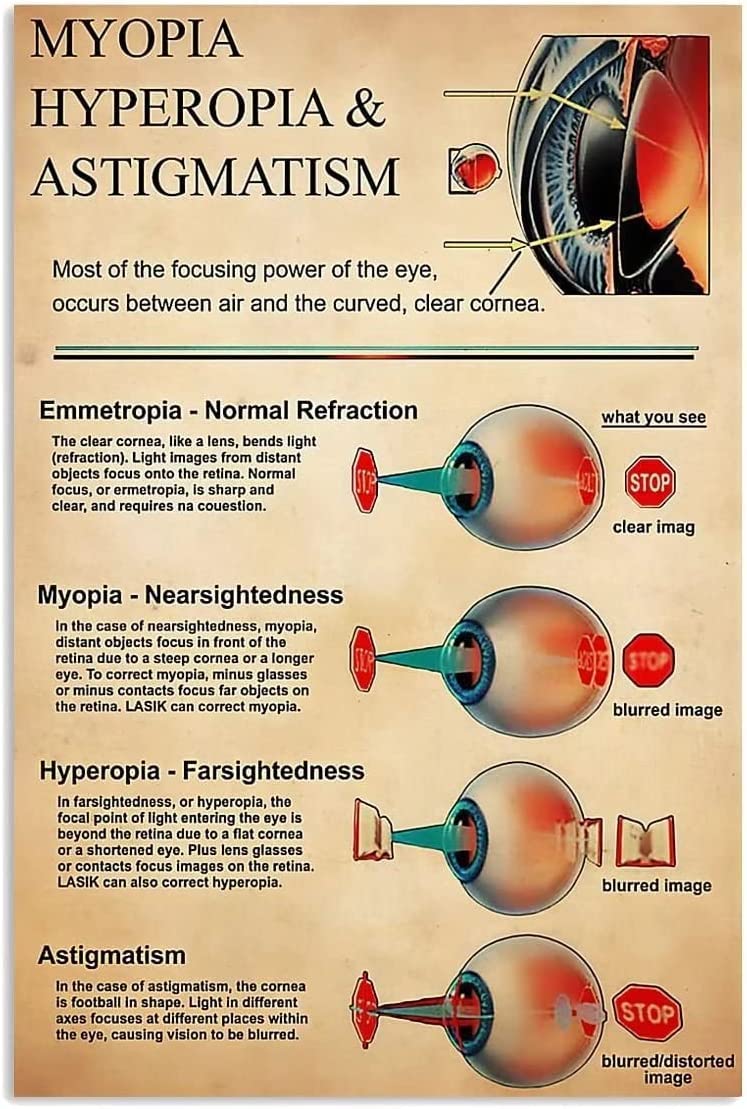 Myopia Hyperopia Astigmatism