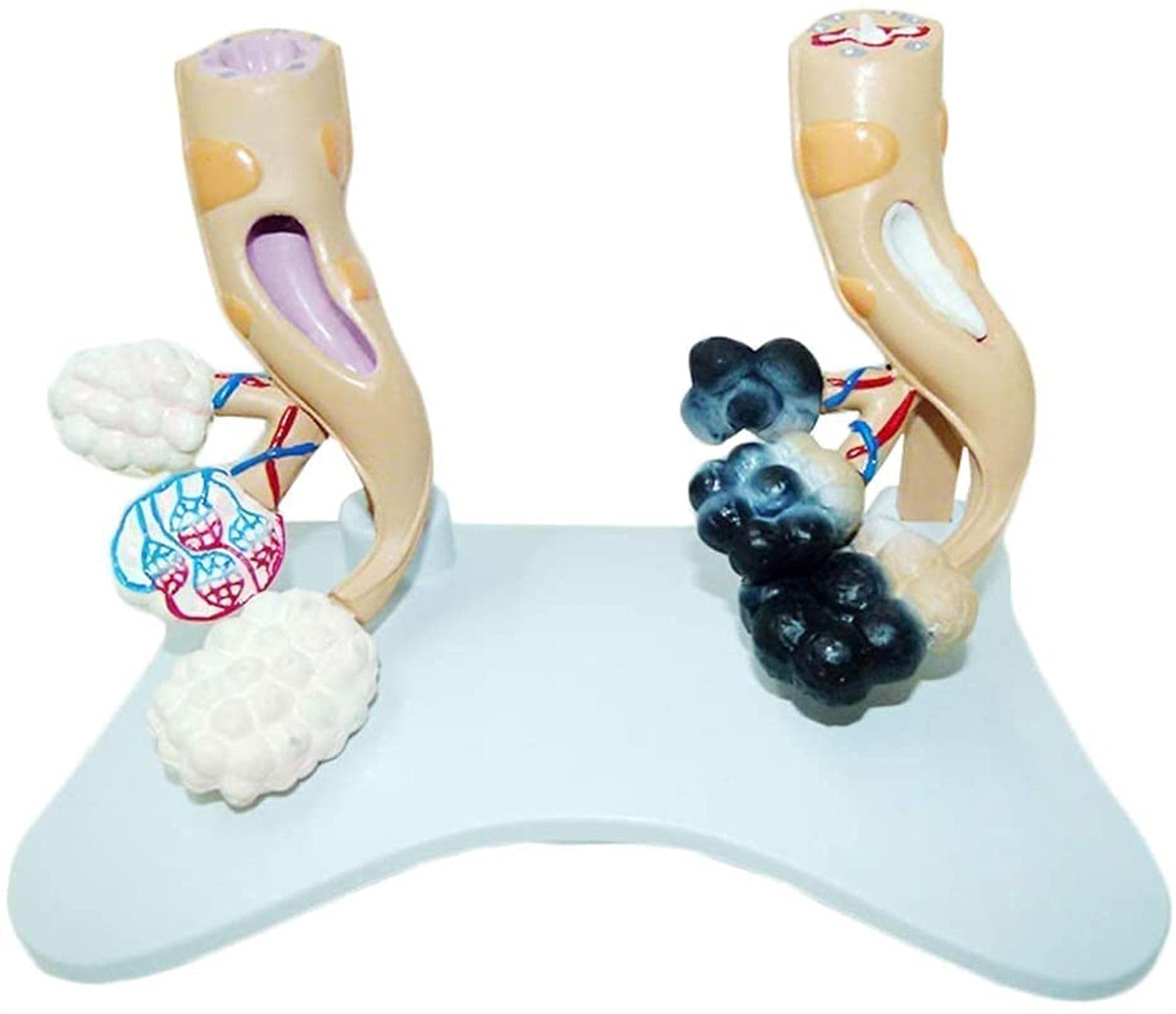 Buy Educational Model Alveolar Model Comparative oking Alveoli And y ...