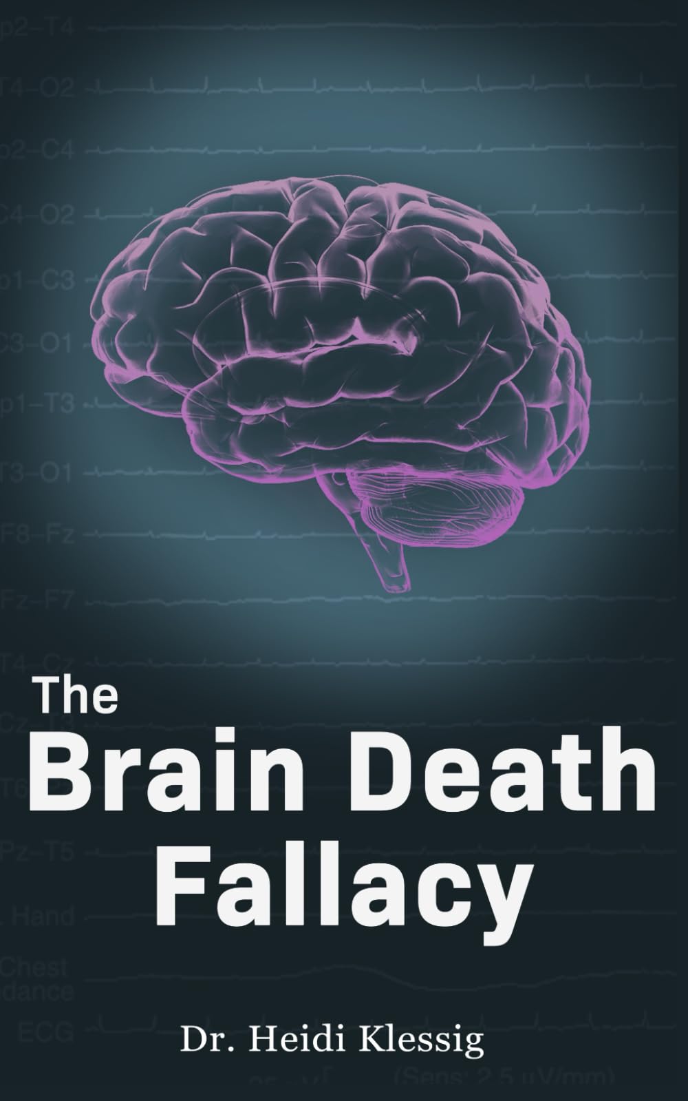 The Brain Death Fallacy: Klessig MD, Heidi: 9798863485003: Amazon.com ...