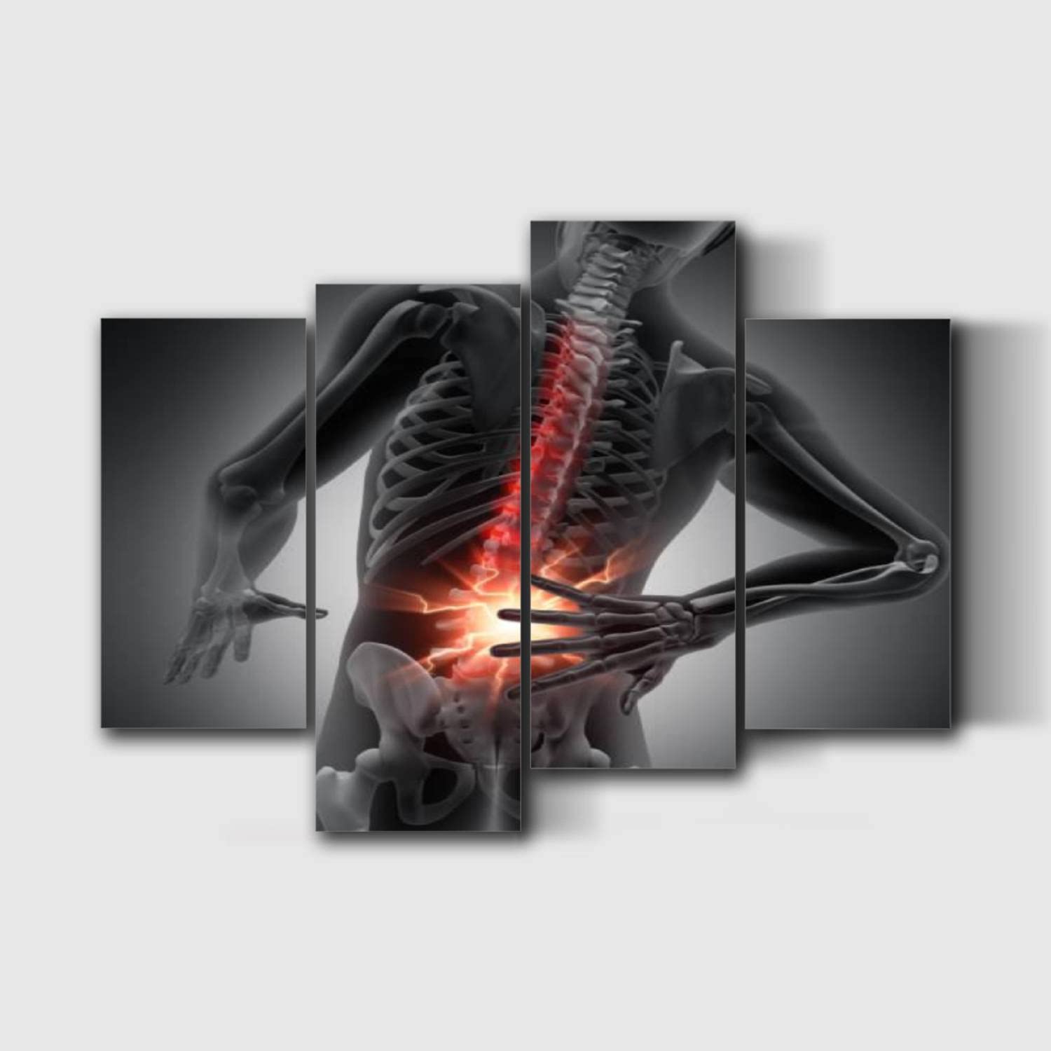 Amazon.com: UJOYAFZSIM Orthopedic Human Anatomy Medical Poster Back ...