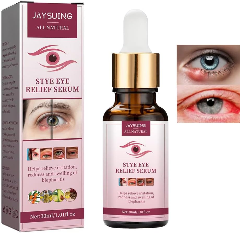 Stye Eye Treatment, Relief Serum for Styes,Chalazion Remover, Drops for ...