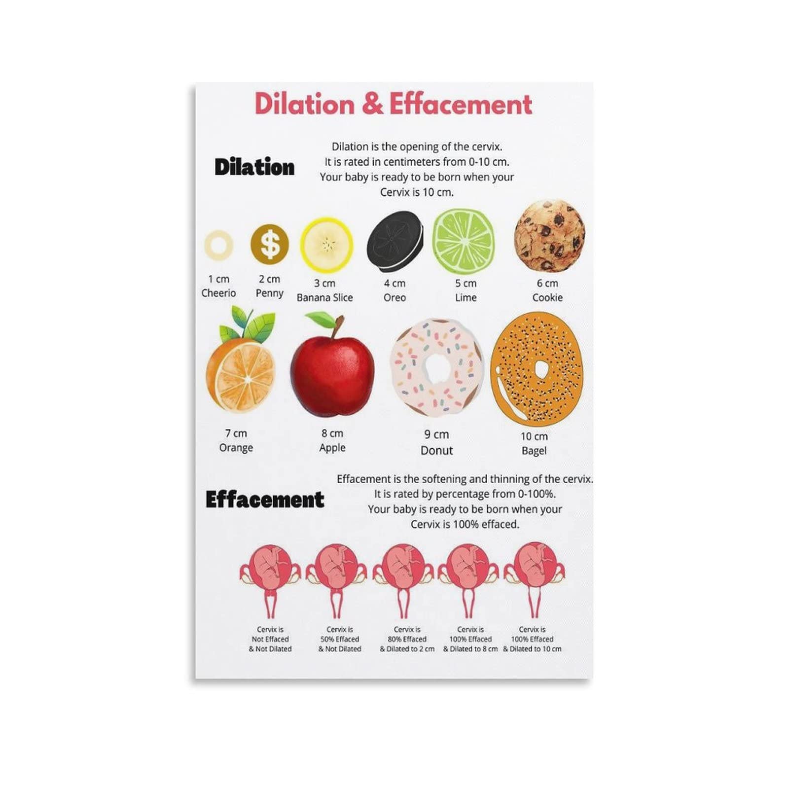 Labor Effacement And Dilation Chart Cervical Dilatation Models, Set Of