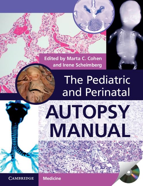 The Pediatric and Perinatal Autopsy Manual with DVD-ROM: 9781107646070 ...