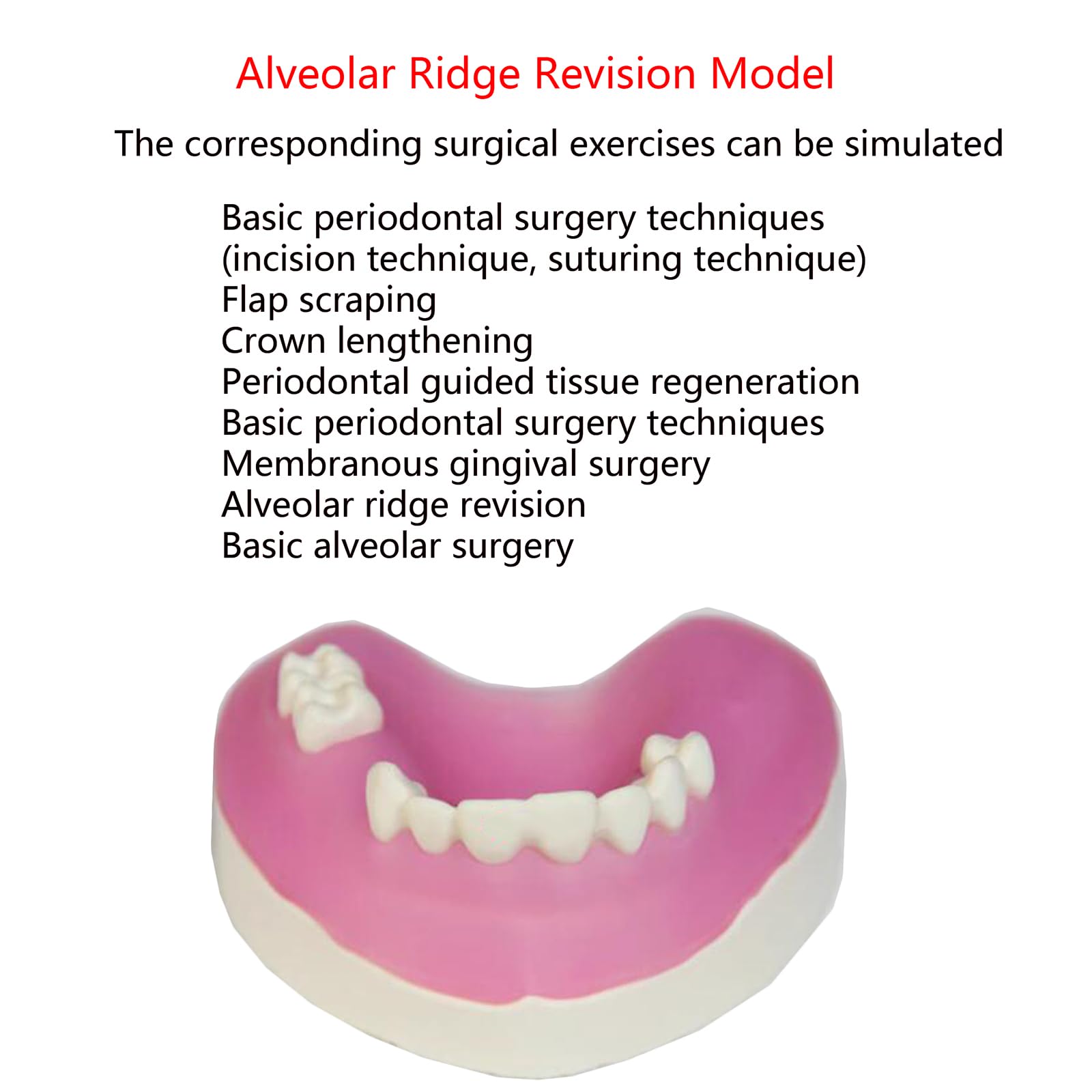Alveolar Ridge Chapter 8 Key Terms Flashcards | Quizlet
