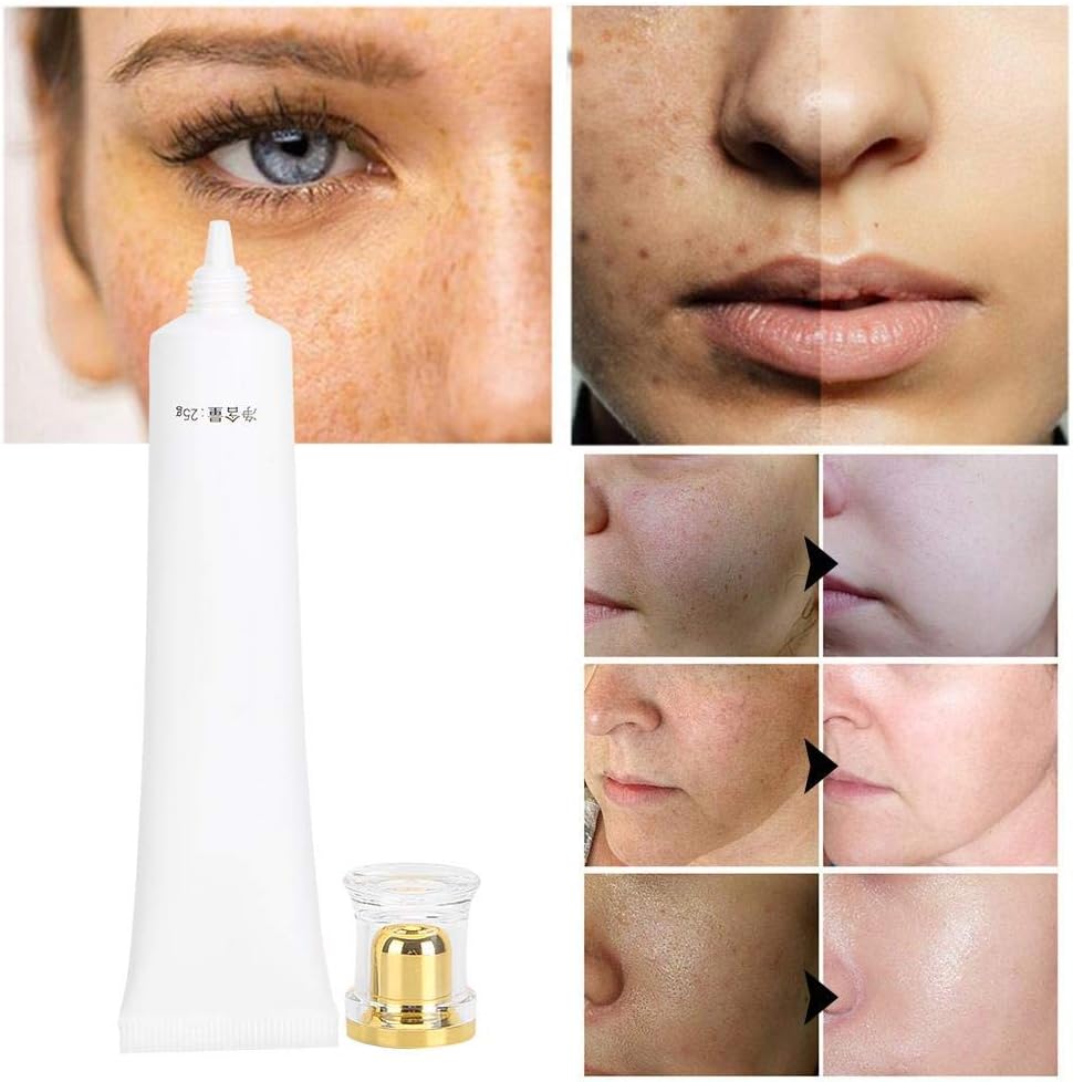 25g Whitening Freckles Fading Cream, Color Spots Removal Moisturizing ...