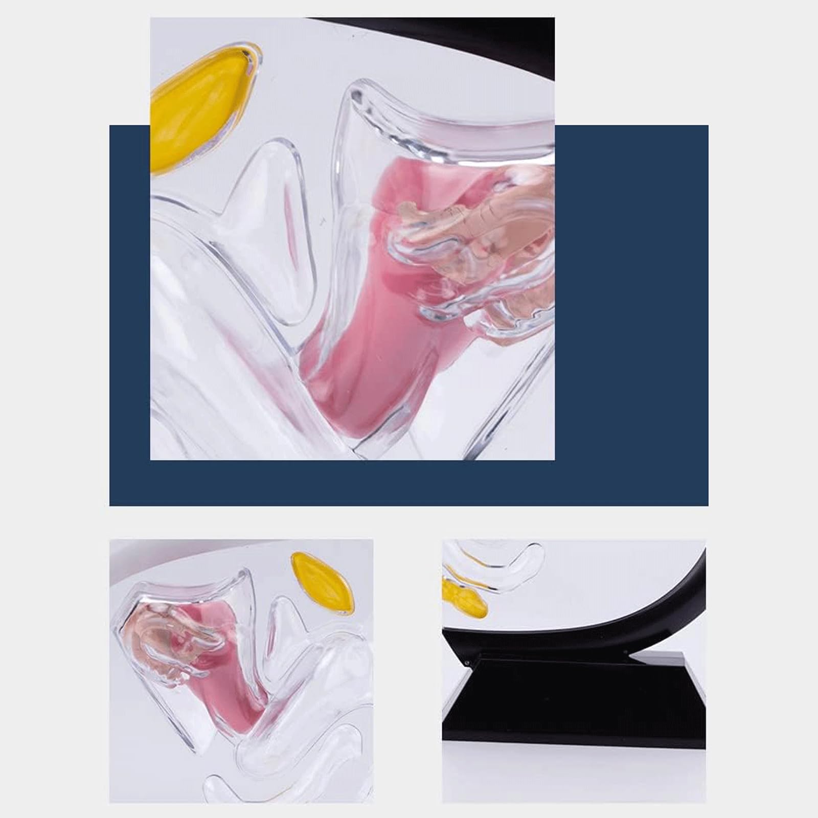 Gynecology Patient Education Transparent Female Reproductive Organ ...