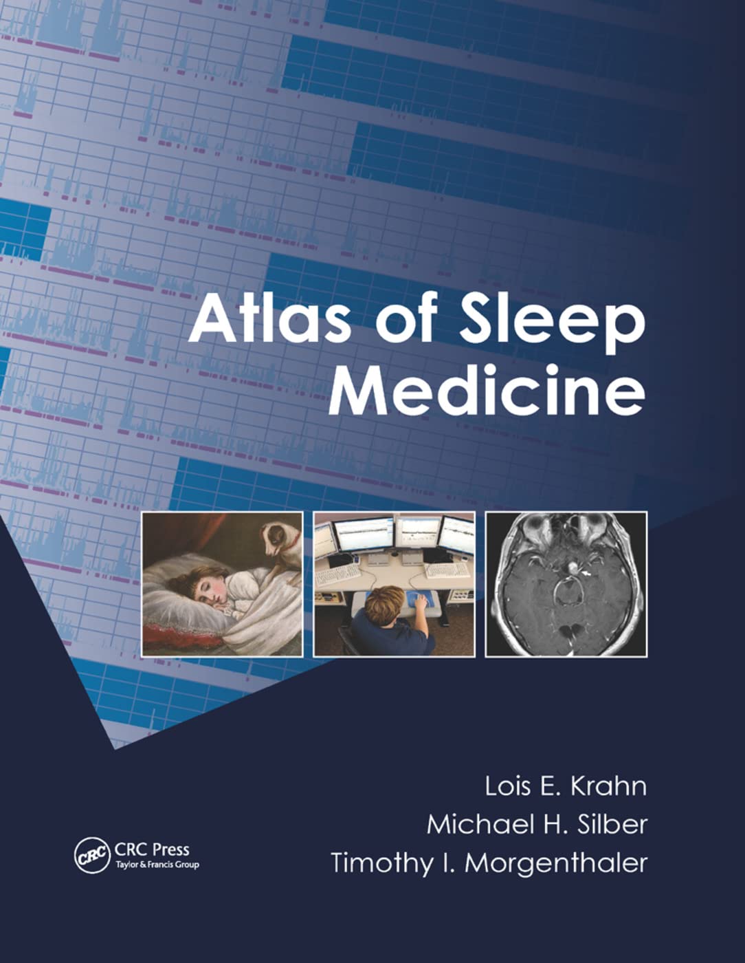 Atlas of Sleep Medicine: 9780367383404: Medicine & Health Science Books ...