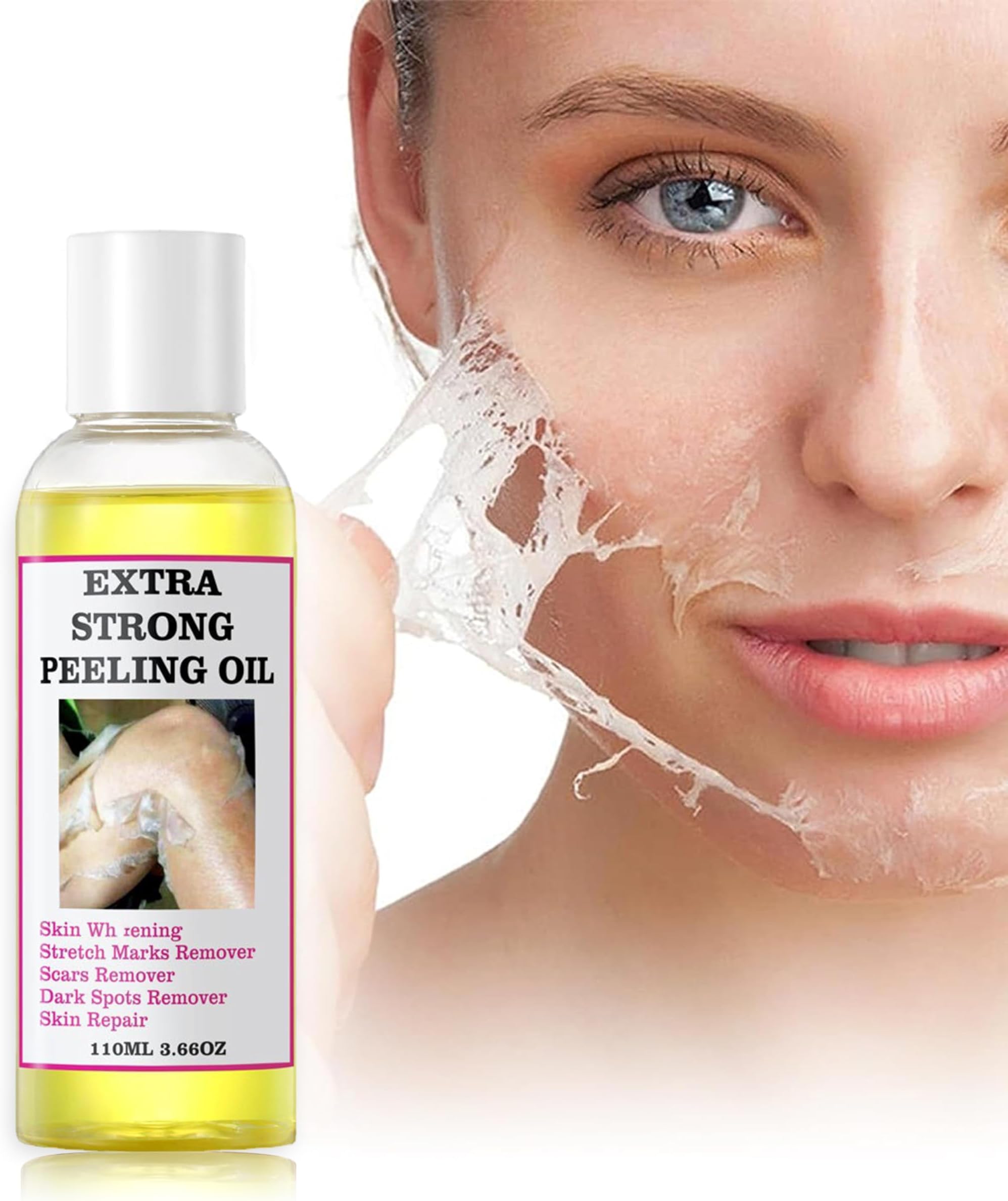 Amazon.com : Yellow Extra Strong Chemical Peeling Oil, Chemical Peel ...