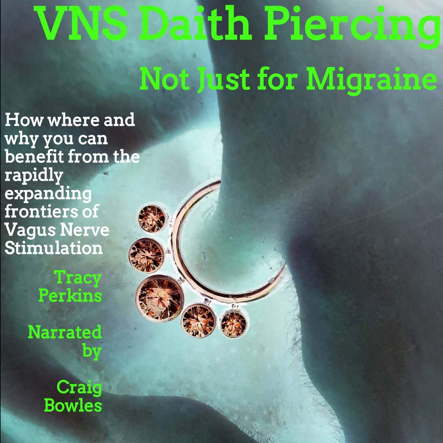 Buy VNS Daith Piercing - Not Just for Migraine: How Where and Why You ...