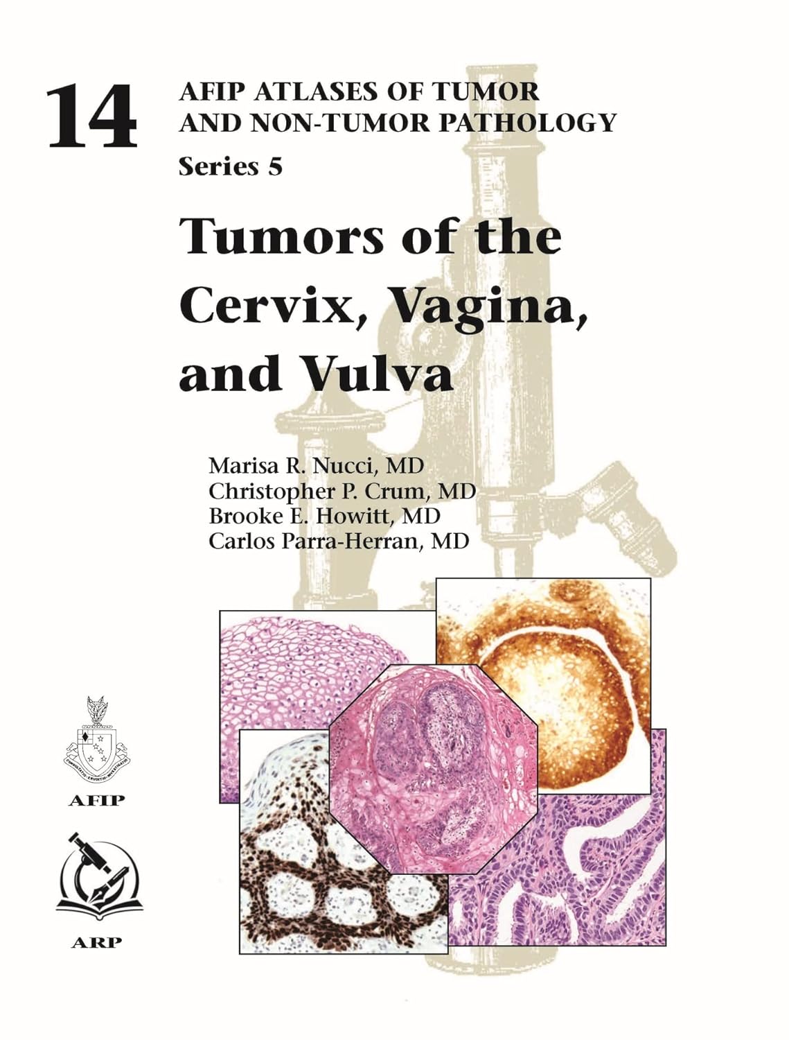 Amazon.fr - Tumors of the Cervix, Vagina, and Vulva - Nucci, Marisa R ...