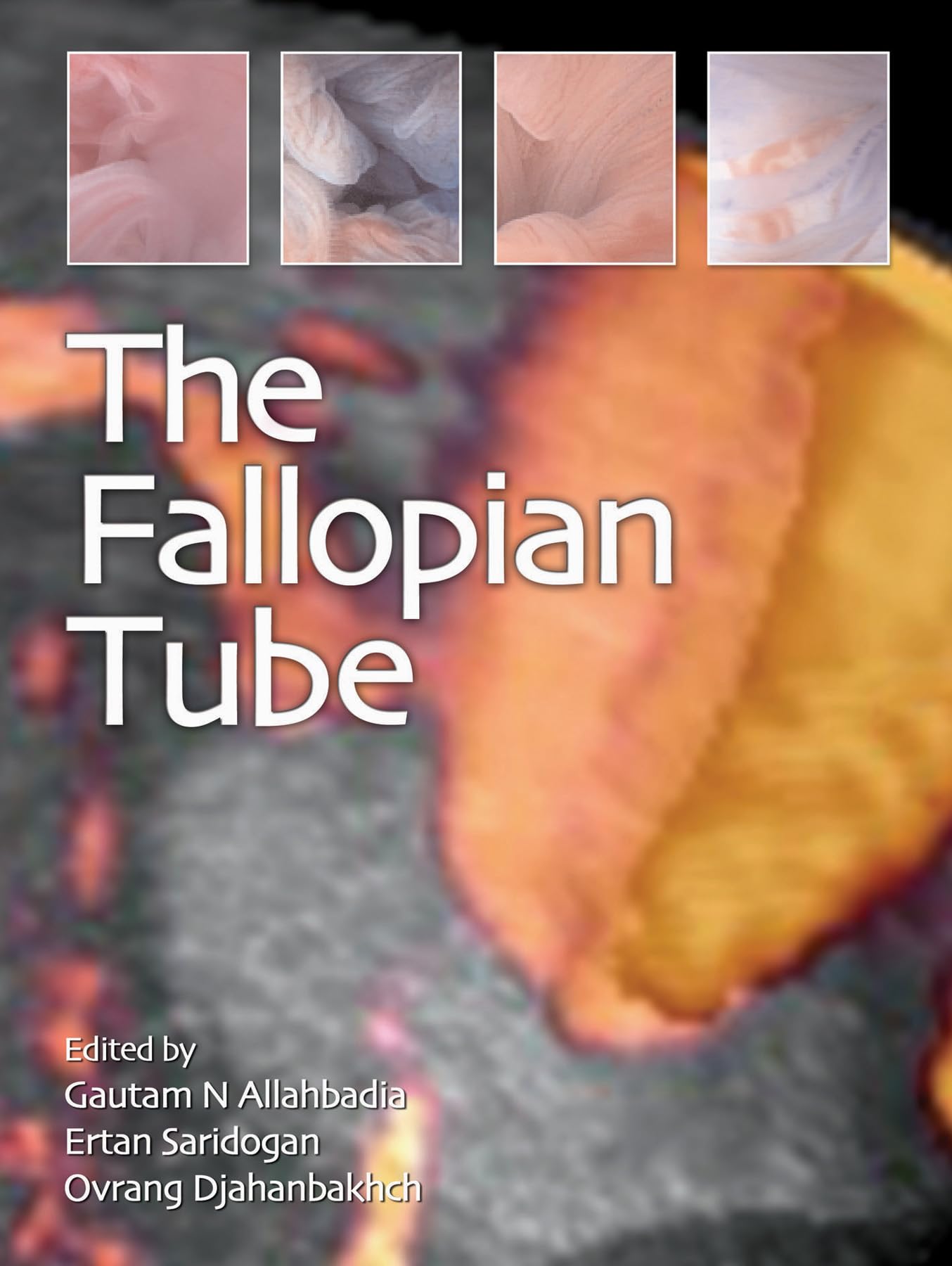 The Fallopian Tube : Gautam Allahbadia, Ertan Saridogan, Professor ...