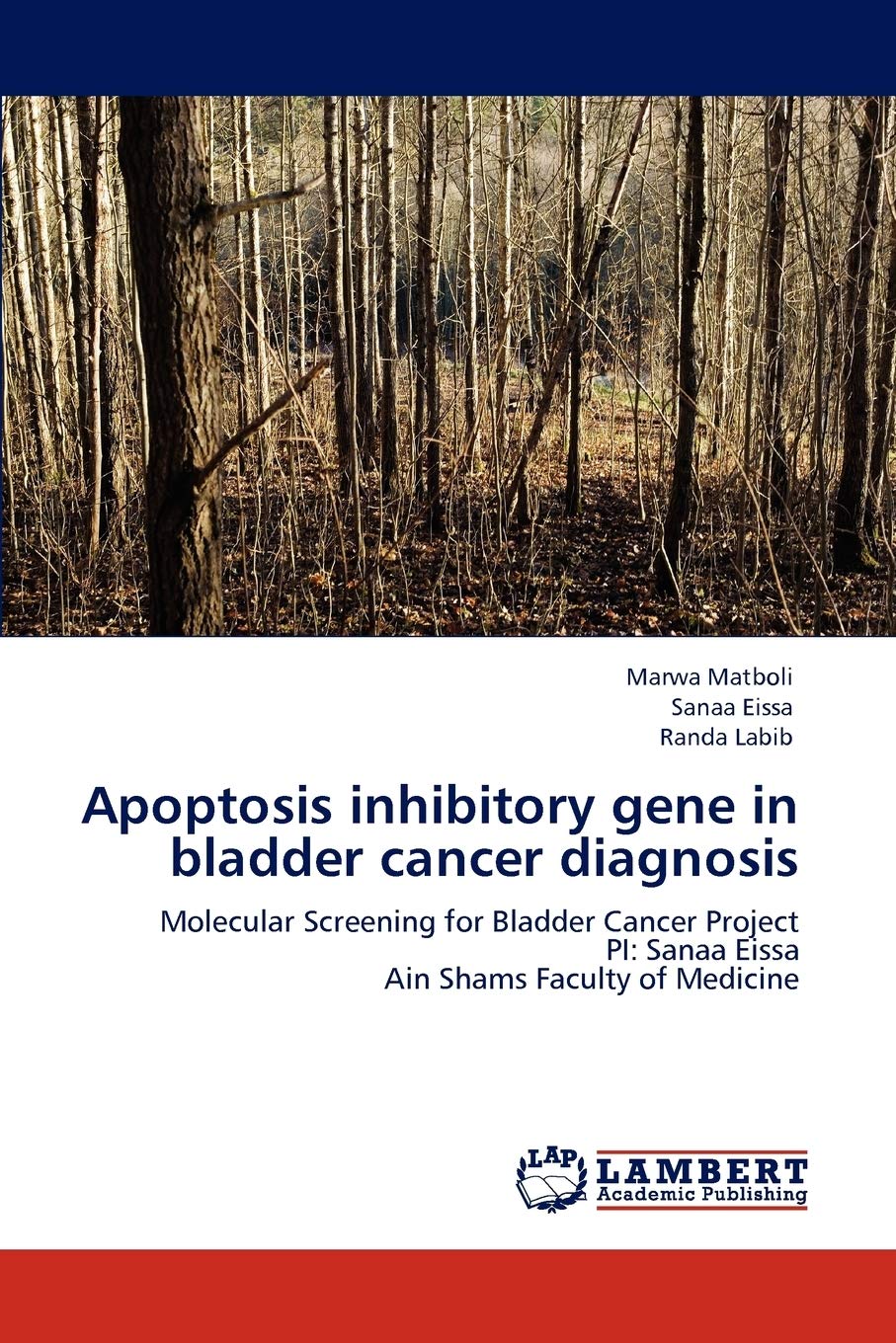 Buy Apoptosis inhibitory gene in bladder cancer diagnosis: Molecular ...