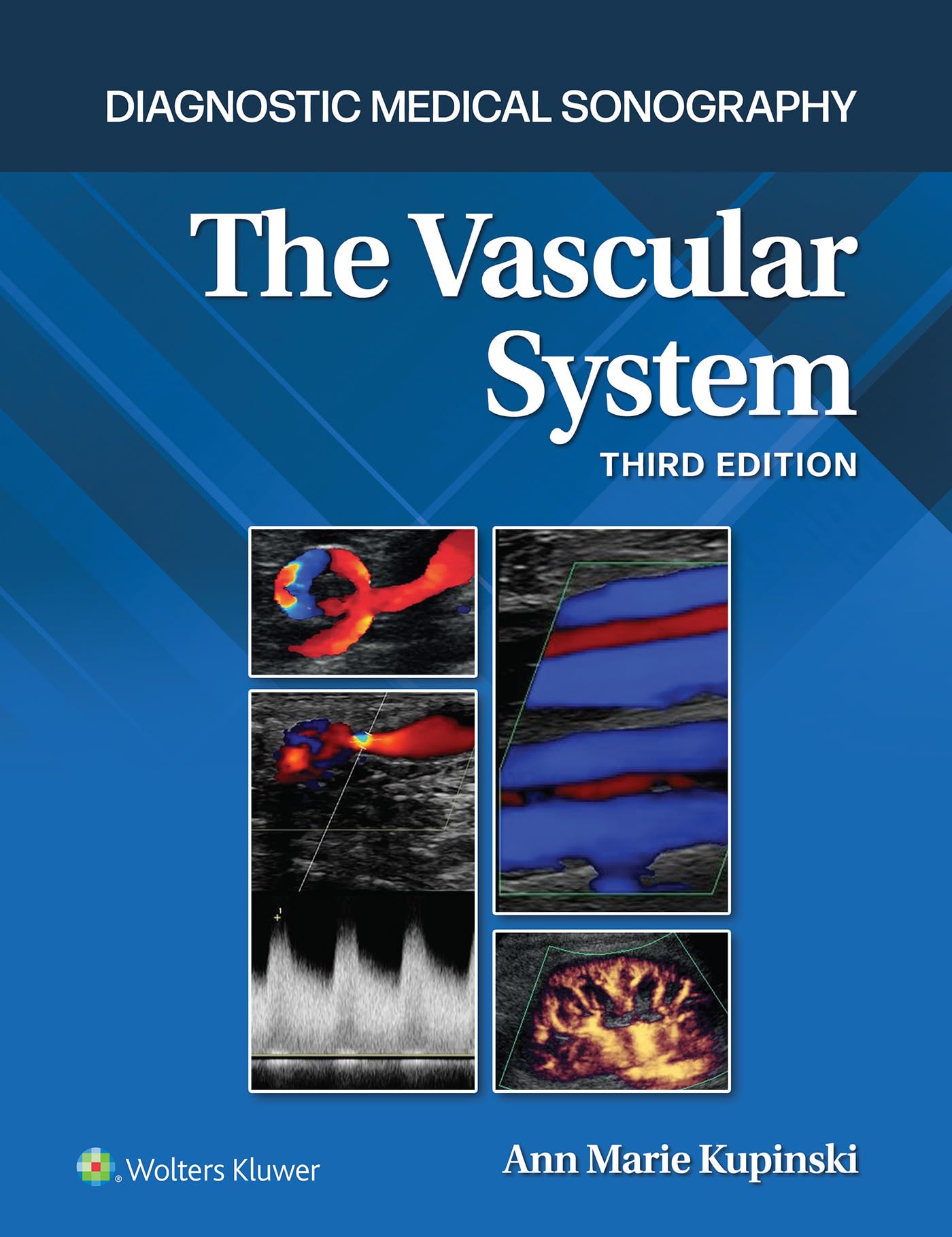 The Vascular System (Diagnostic Medical Sonography Series): The ...