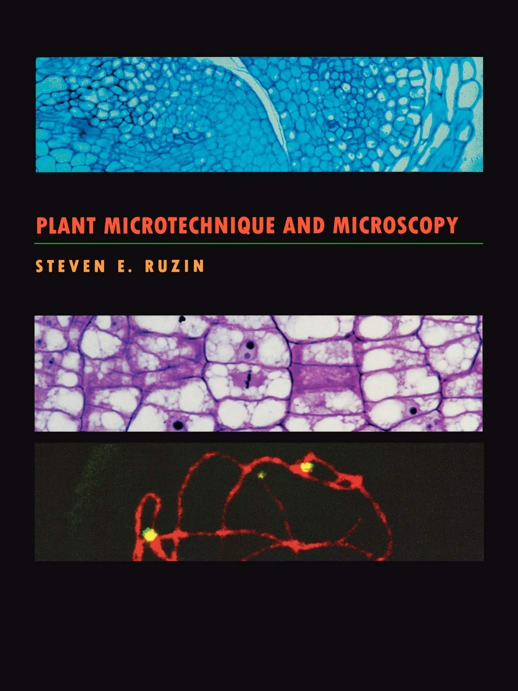 Amazon.com: Plant Microtechnique and Microscopy: 9780195089561: Ruzin ...