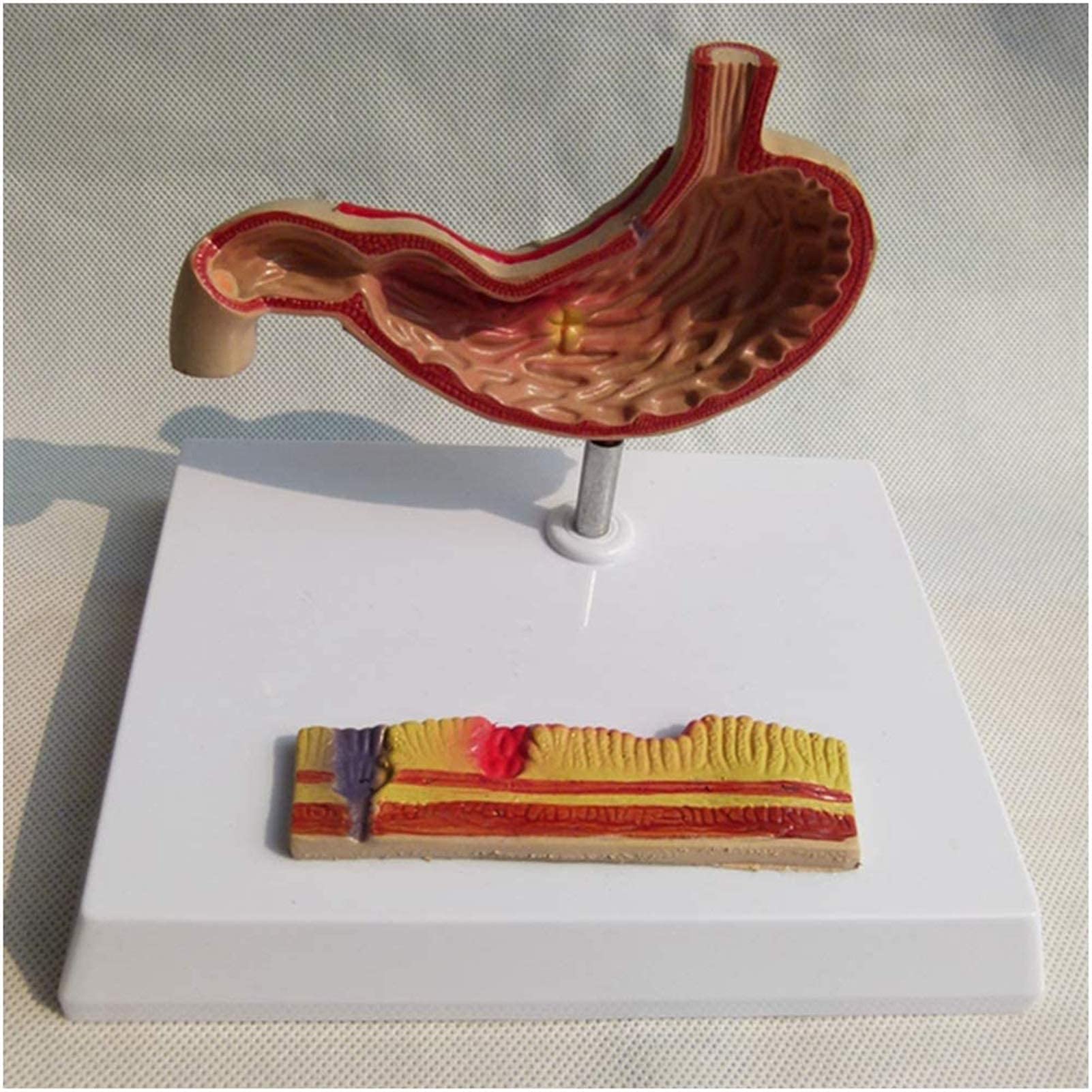 Buy Study Model Human Organ Anatomy Model Human Stomach Lesion Model ...