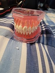 Amazon.com: Dental Implant Teeth Model Study Teach Standard Model with ...