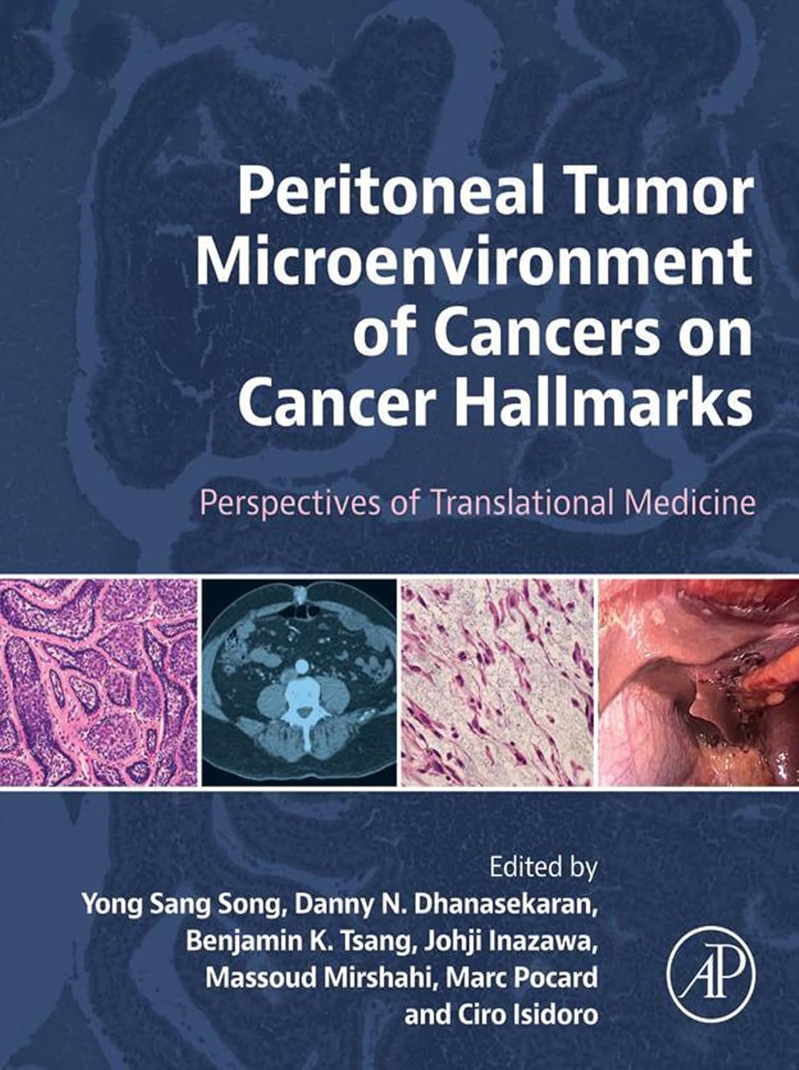 Amazon.com: Peritoneal Tumor Microenvironment of Cancers on Cancer ...