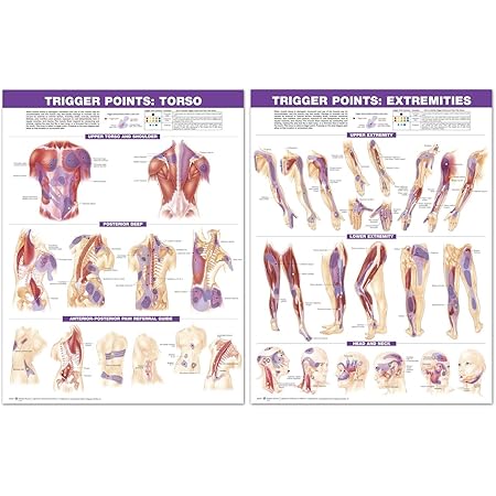 Amazon.com: Trigger Point Chart Set: Torso & Extremities Lam ...